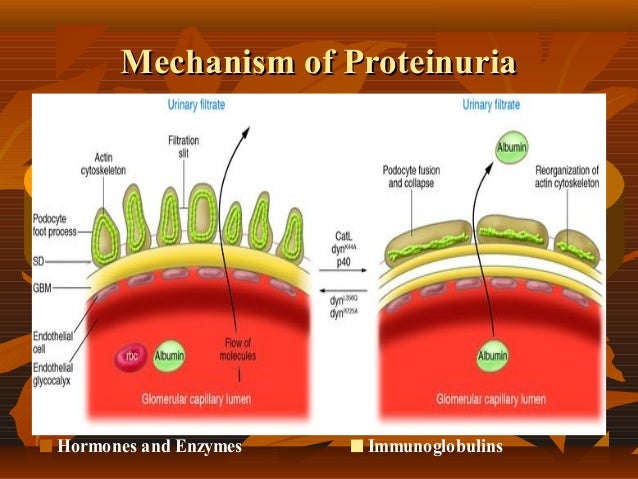 Proteinuria how to approach