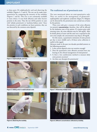 Proteinuria as a clinical tool | PDF