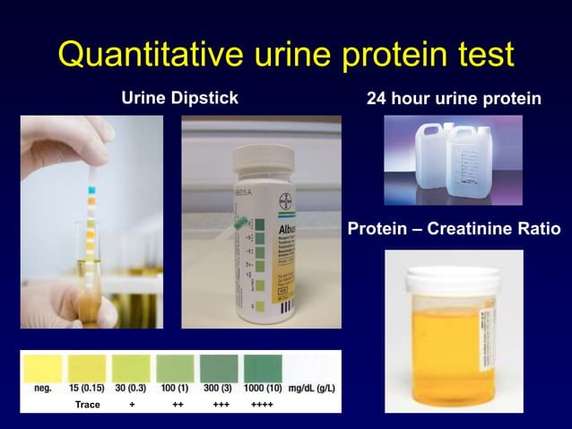 APPROACH TO PROTEINURIA