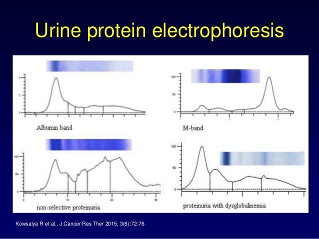 APPROACH TO PROTEINURIA