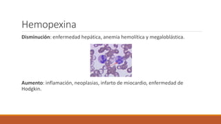Proteínas plasmáticas y su significado clínico (1).pptx