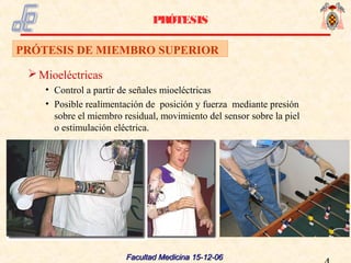 Protesis | PPT