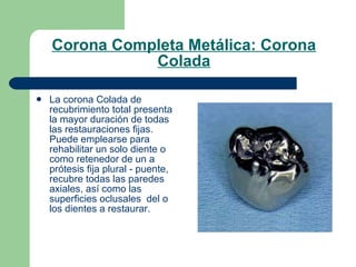 Protesis De Corona Ok | PPT
