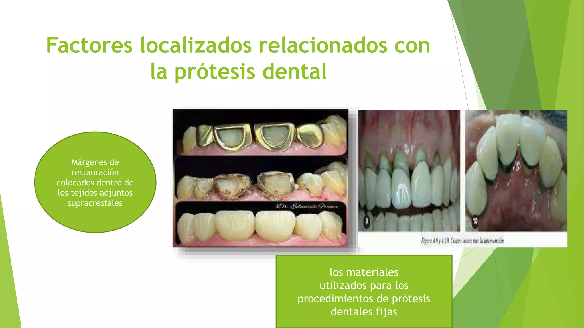 PROTESIS DENTAL Y FACTORES RELACIONADOS CON LOS DIENTES.pptx