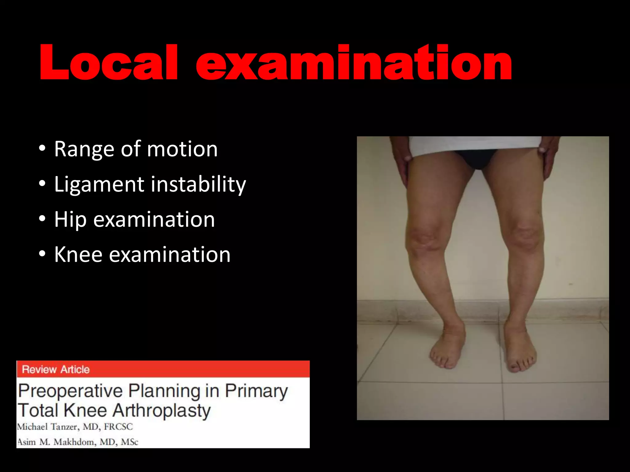 Protesis de rodilla | PPTX