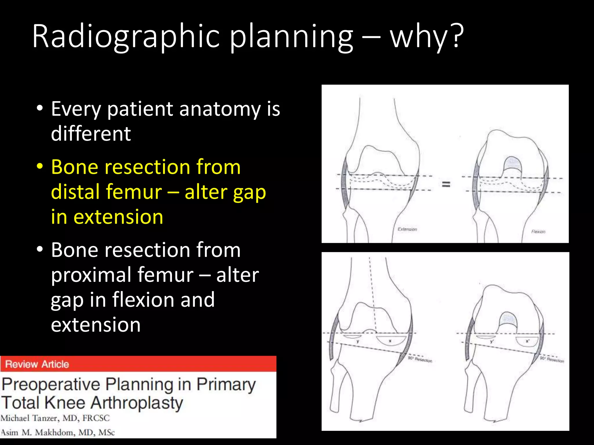 Protesis de rodilla | PPTX