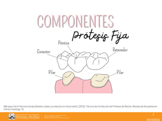 Prótesis fija (pontico y características) | PDF