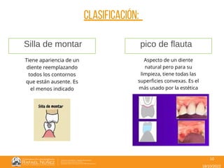 Prótesis fija (pontico y características) | PDF