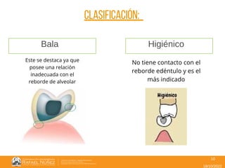 Prótesis fija (pontico y características) | PDF