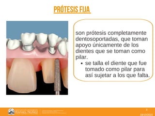 Prótesis fija (pontico y características) | PDF