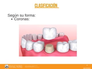 Prótesis fija (pontico y características) | PDF