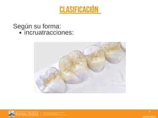 Prótesis fija (pontico y características) | PDF
