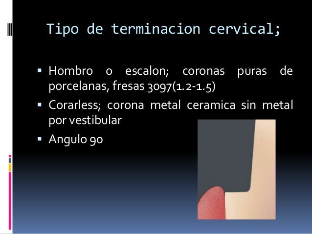 Protesis fija , principios fundamentales