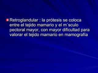 Protesis mamaria | PPT