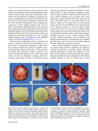 Protesis mamaria, linfoma anaplasico | PDF | Cancer | Diseases and ...