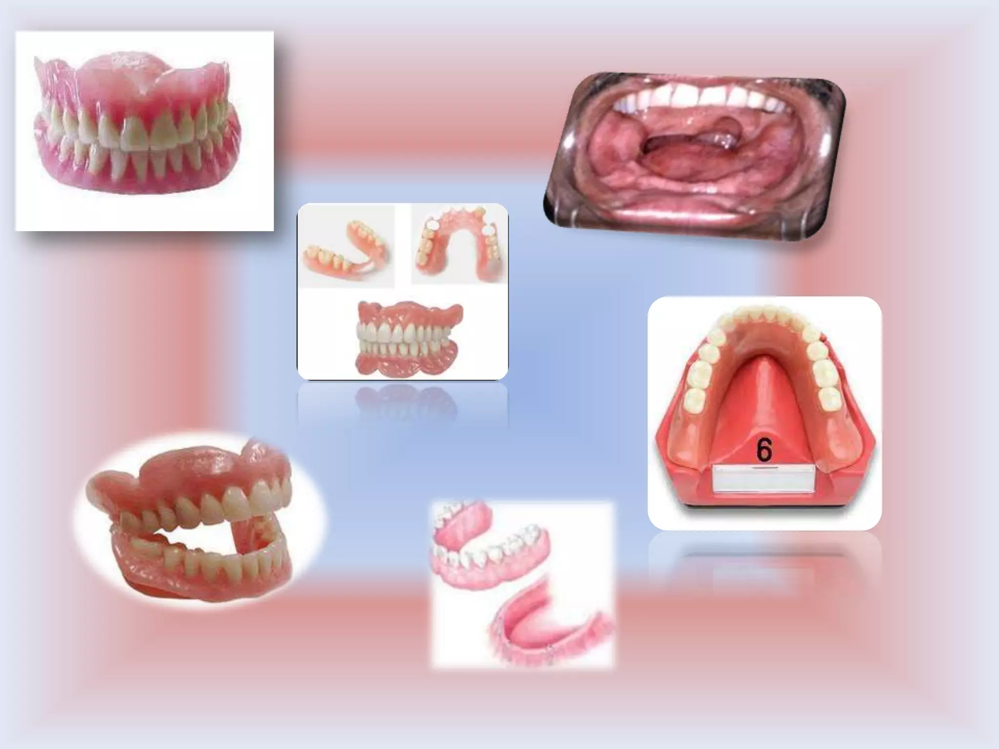 Protesis totales | PPT