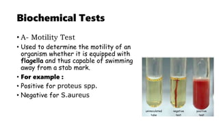 PROTEUS MIRABILIS slideshare presentation | PPTX | Digestive Disorders ...