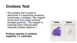 PROTEUS MIRABILIS slideshare presentation | PPTX
