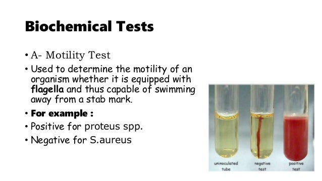 PROTEUS MIRABILIS slideshare presentation