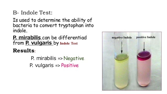 Urease Test For Pseudomonas Aeruginosa