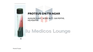 PROTEUS | PDF
