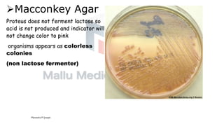 Proteus Mirabilis On Macconkey Agar