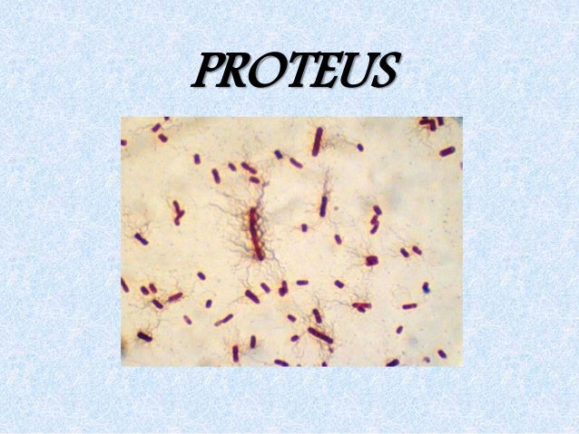 Proteus Spp 2