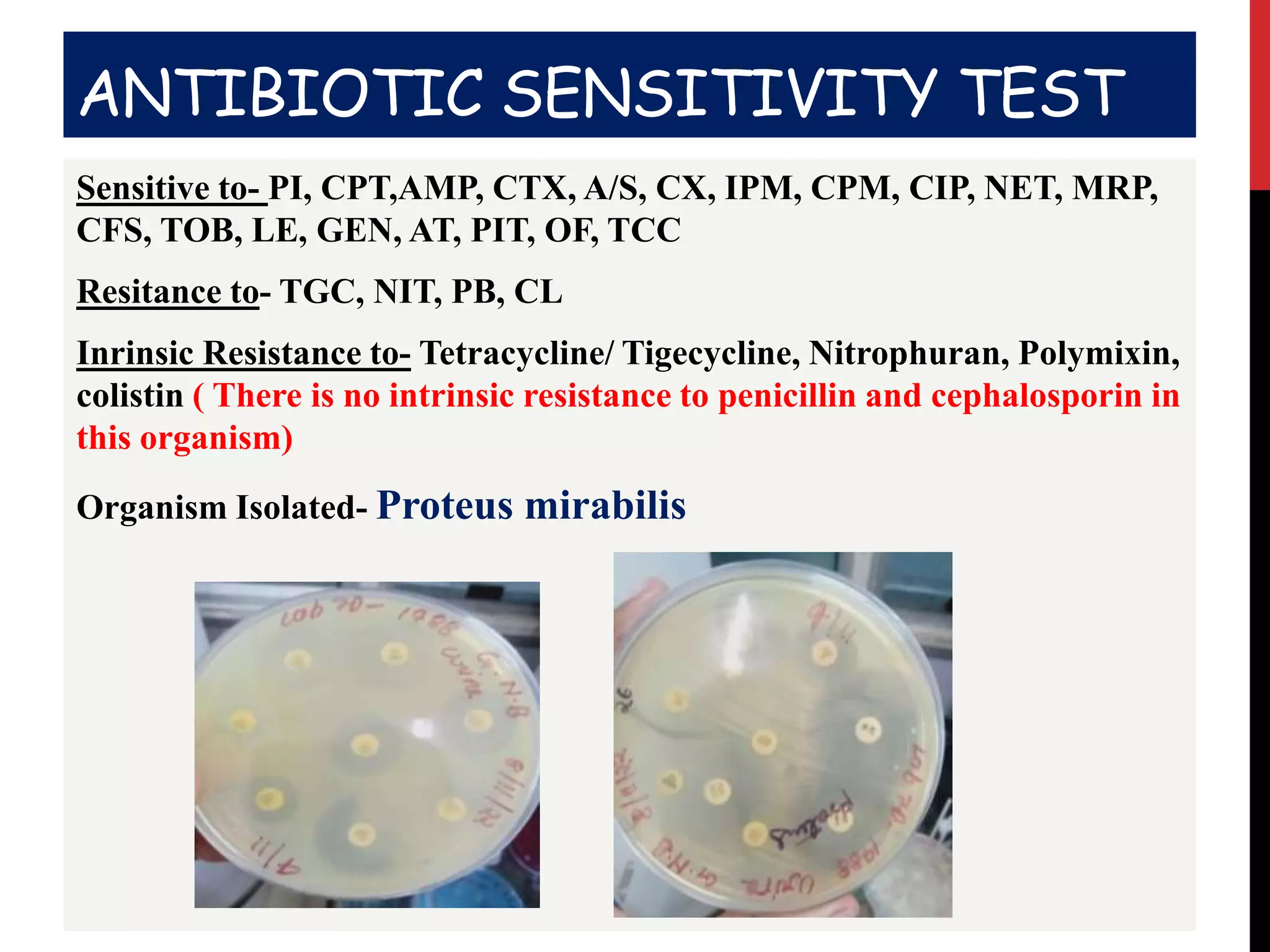 Clinical case presentation, Proteus mirabilis.pptx