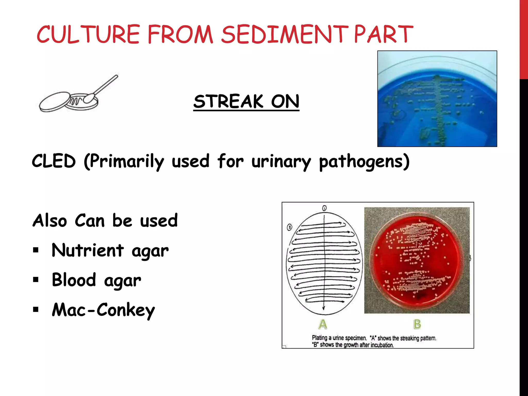 Clinical case presentation, Proteus mirabilis.pptx