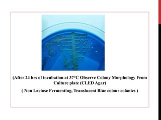 Clinical case presentation, Proteus mirabilis.pptx