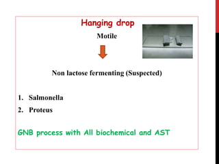 Clinical case presentation, Proteus mirabilis.pptx