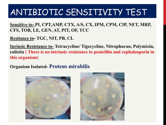 Clinical case presentation, Proteus mirabilis.pptx