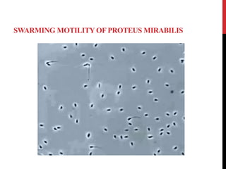 Clinical case presentation, Proteus mirabilis.pptx