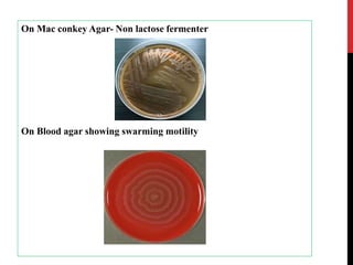 Clinical case presentation, Proteus mirabilis.pptx