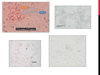 Clinical case presentation, Proteus mirabilis.pptx