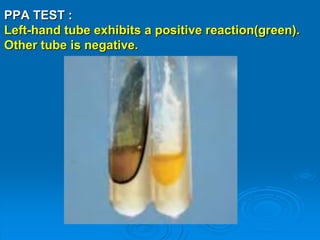 Proteus mahadi ppt | PDF