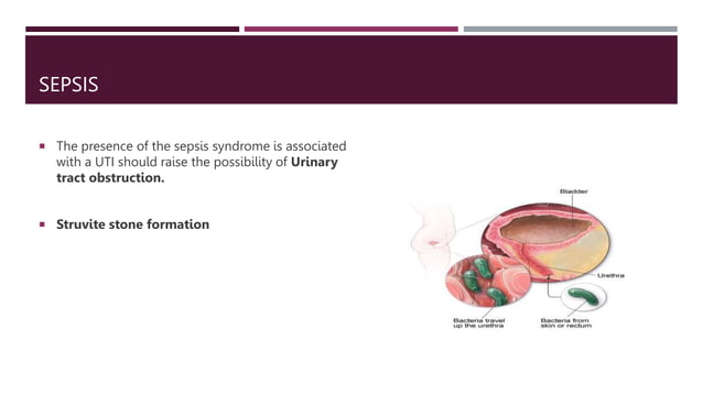 Proteus Mirabilis.pptx | Infectious Diseases | Diseases and Conditions