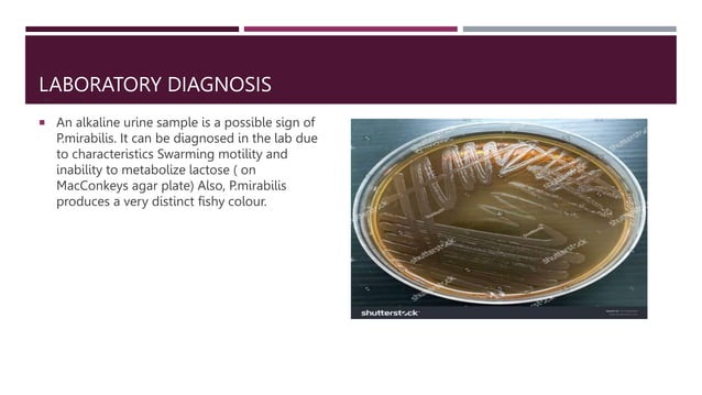Proteus Mirabilis.pptx | Infectious Diseases | Diseases and Conditions