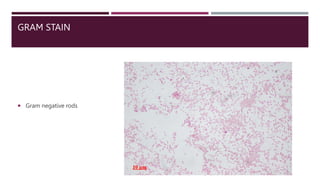 Proteus Mirabilis.pptx