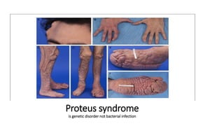Proteus spp. | PPTX