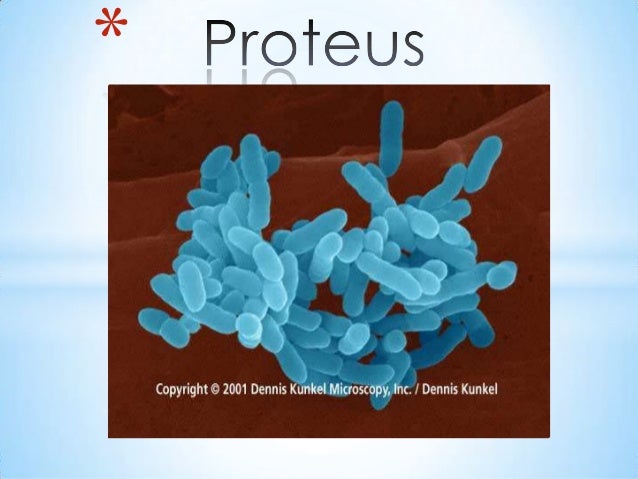Proteus Spp 2