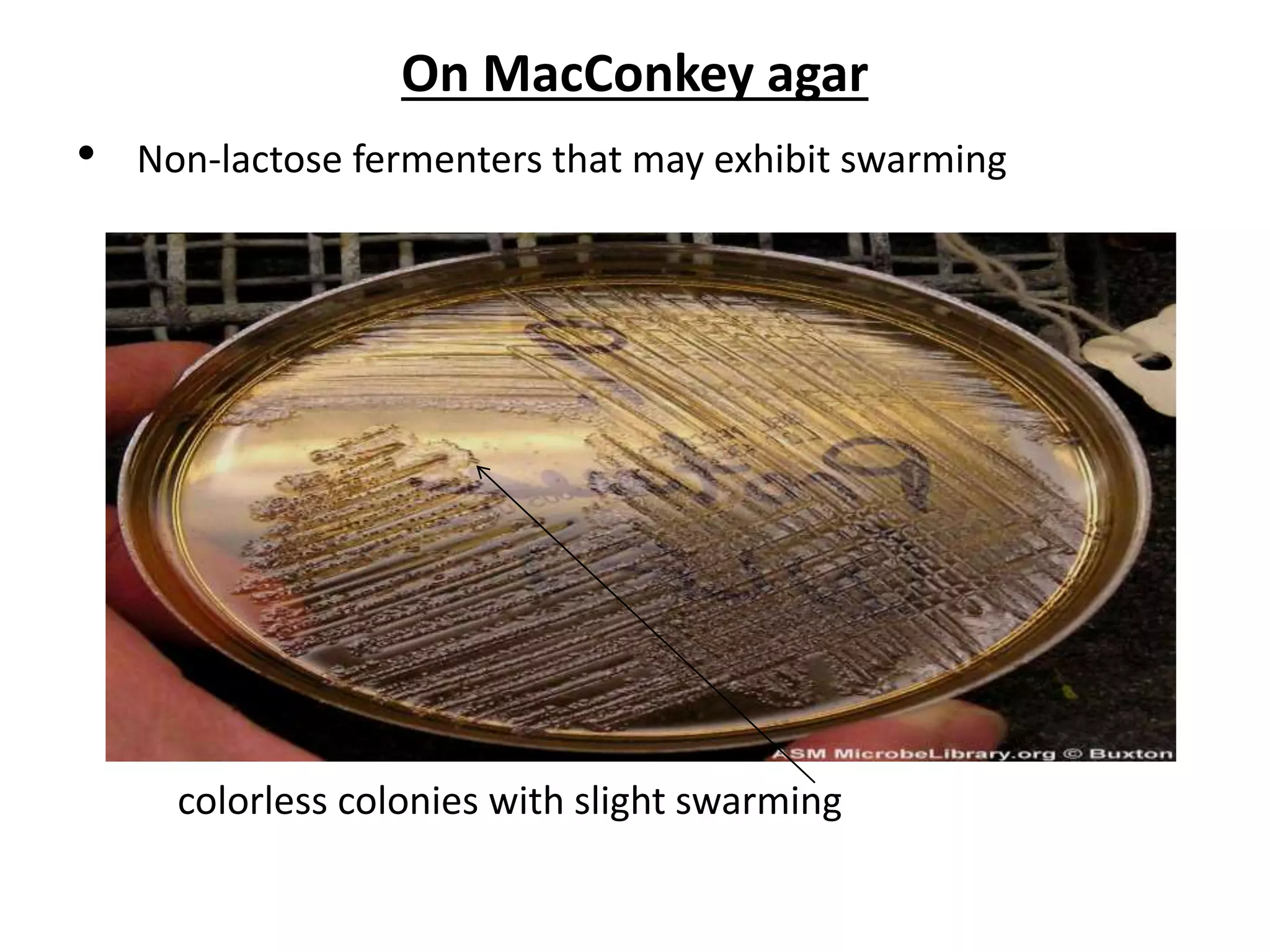 Proteus spp lecture | PPTX