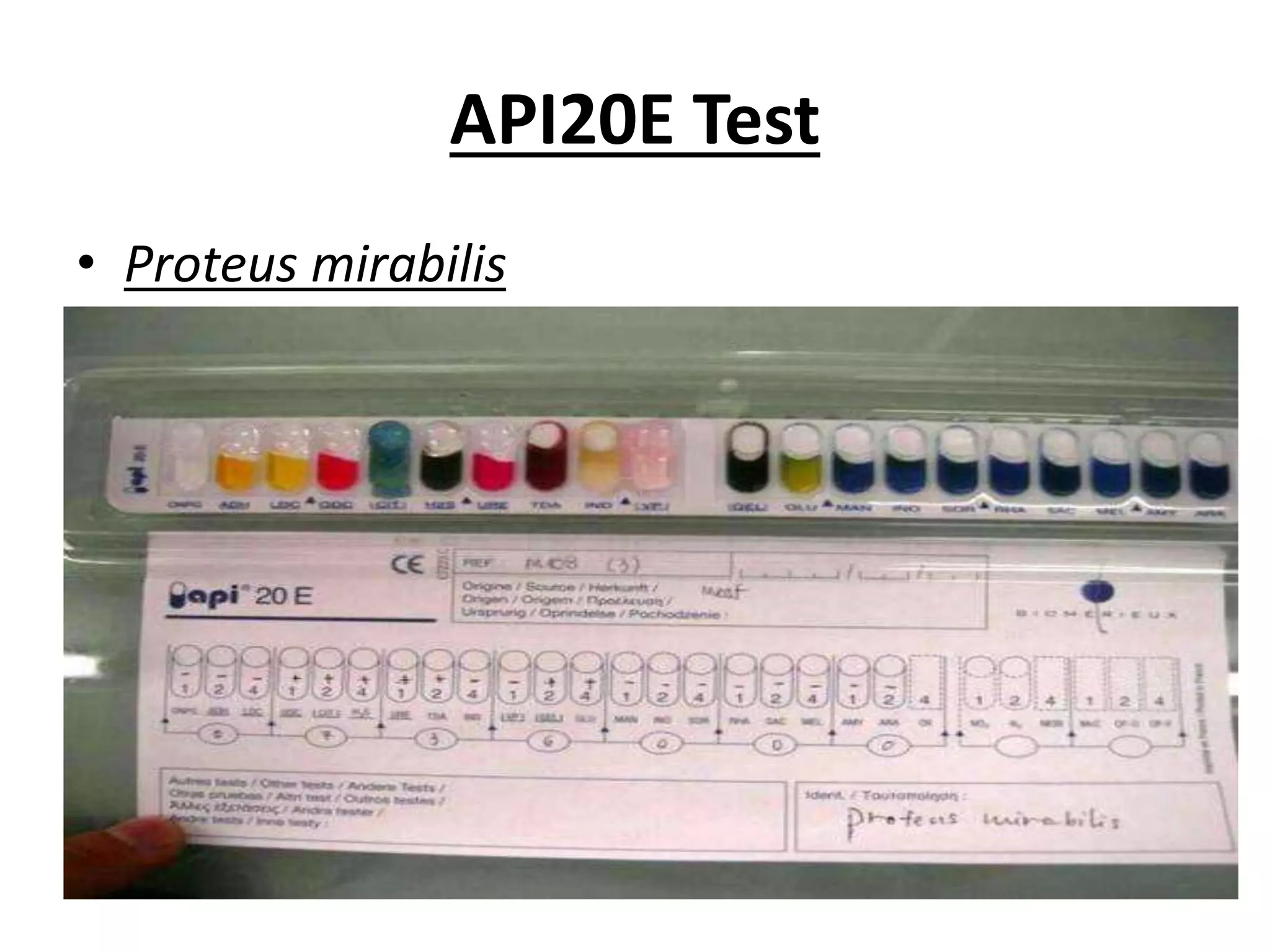 Proteus spp lecture | PPTX