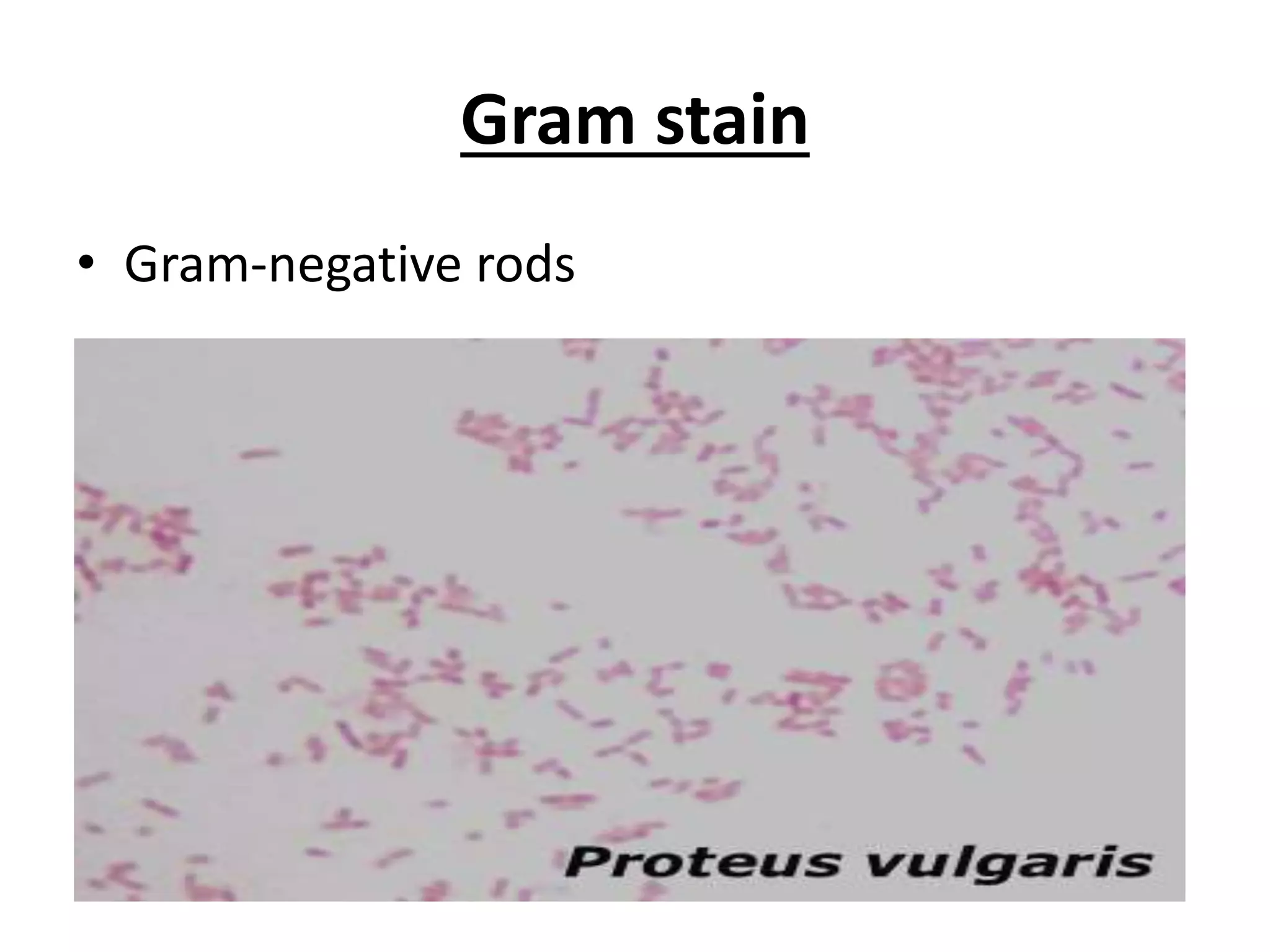 Proteus spp lecture | PPTX
