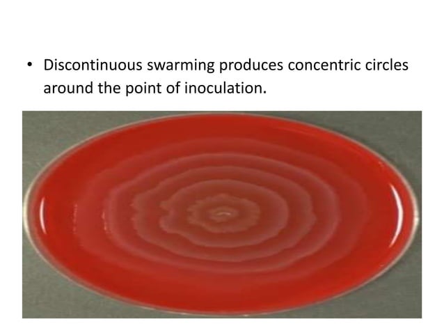 Proteus spp lecture | PPTX