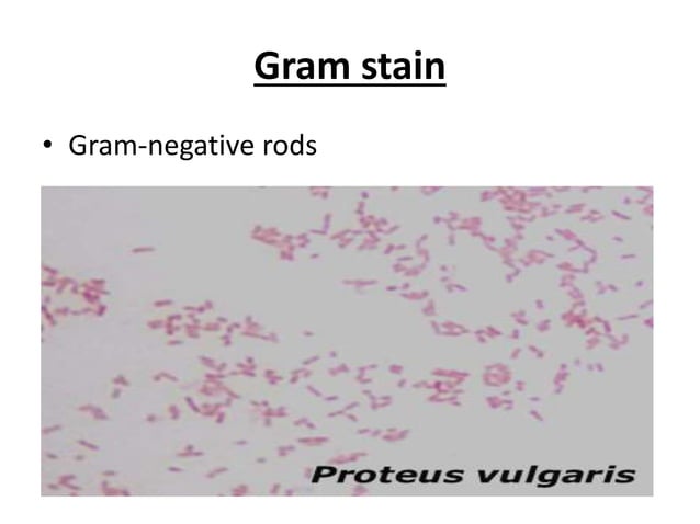Proteus spp lecture | PPTX