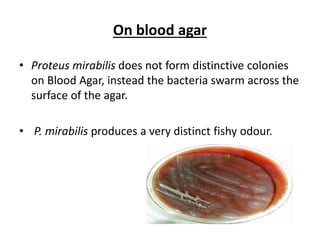 Proteus spp lecture | PPTX
