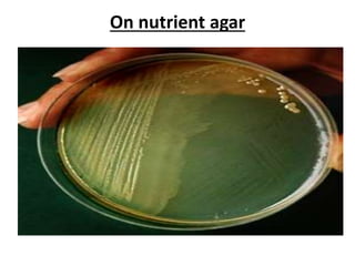 Proteus Mirabilis On Nutrient Agar