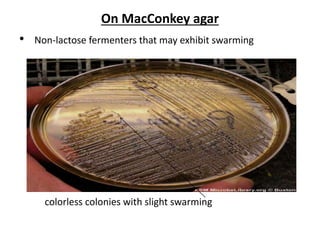 Proteus Mirabilis On Macconkey Agar
