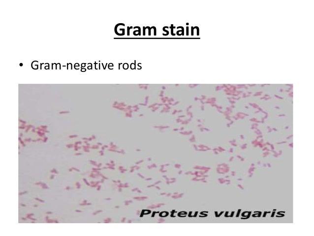 Proteus Vulgaris Gram Stain